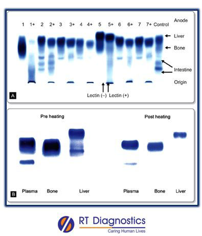 Alkaline Phostase With Bone Fraction | RT Diagnostics