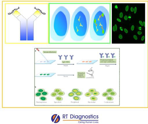 ANA | RT Diagnostics
