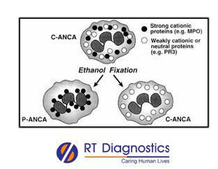 ANCA - Mpo (P-Anca) | RT Diagnostics