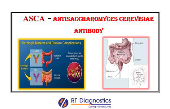 ASCA - IgA | RT Diagnostics