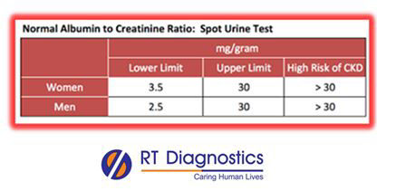 Albumin/Creatinine Ratio | RT Diagnostics