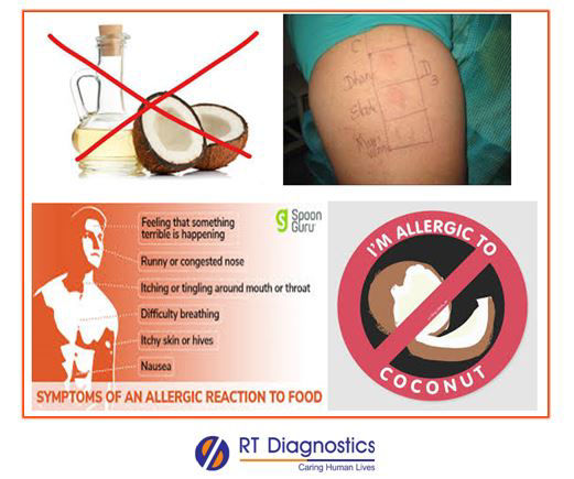 Allergen - Coconut | RT Diagnostics