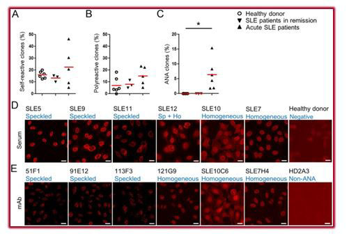 Anti Ds DNA (IF Method) | RT Diagnostics