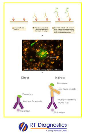Anti Ds DNA (IF Method) | RT Diagnostics