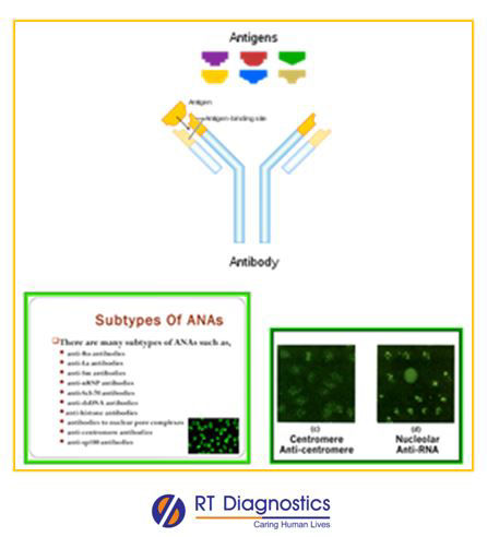 Anti Centromere Antibody | RT Diagnostics