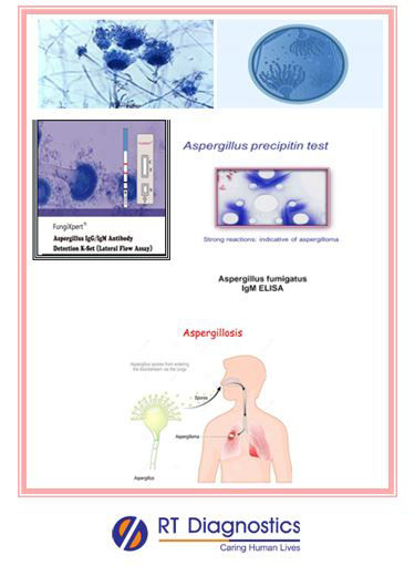 Aspergillosis Ab - IgM - Serum | RT Diagnostics