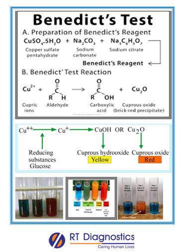 Benedicts-Urine | RT Diagnostics