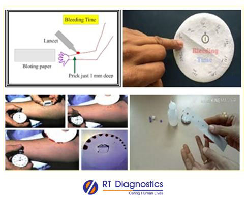 Bleeding Time | RT Diagnostics
