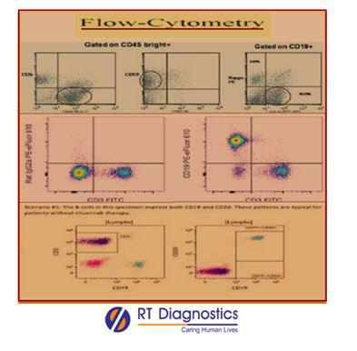 CD -19 Flow Cytometry | RT Diagnostics