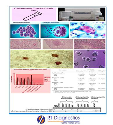Chlamydia Trachomatis IgA | RT Diagnostics