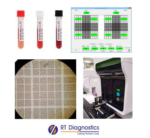 Cell Count For Fluid | RT Diagnostics