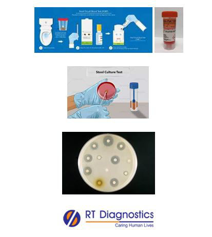 Culture & Sensitivity - Stool | RT Diagnostics