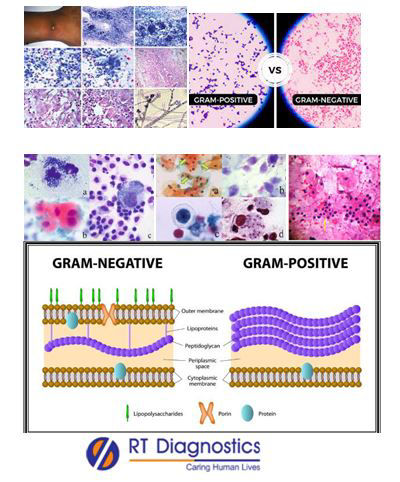 Cytology - Pus | RT Diagnostics
