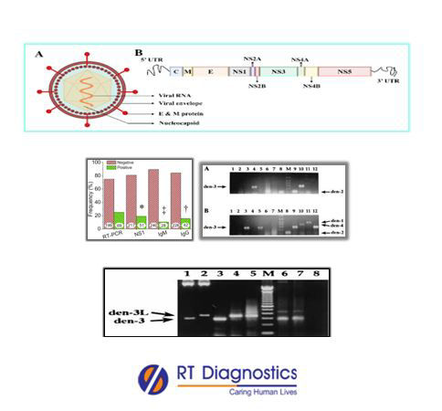 Dengue Virus (RNA Qualitative RT - PCR) | RT Diagnostics
