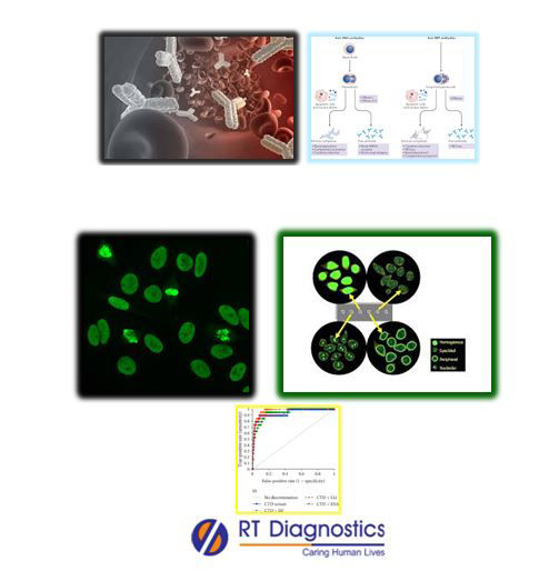ENA Screen | RT Diagnostics