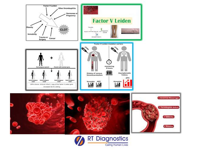 Factor V Leiden Functional Assay | RT Diagnostics