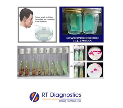 Fluid For AFB | RT Diagnostics