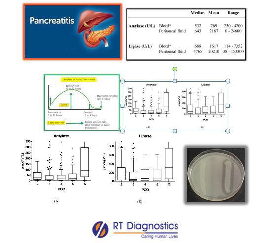 Fluid For Lipase | RT Diagnostics