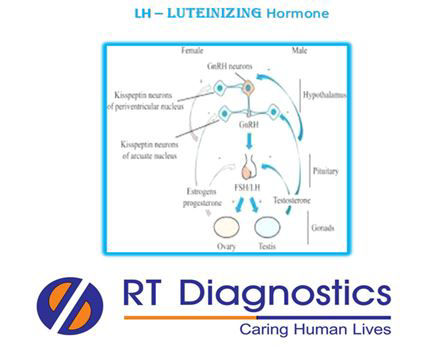 Book Luteinizing Hormone(LH) Blood Test | RT Diagnostics