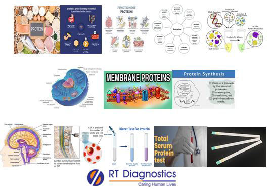 Protein - CSF Fluid | RT Diagnostics
