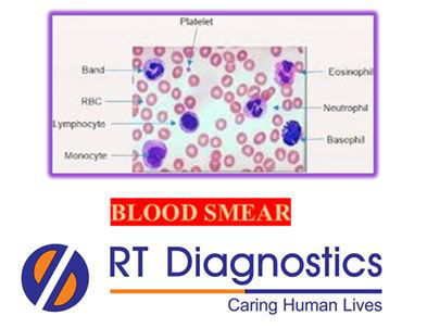 # Smear Study (Microscopic) | RT Diagnostics