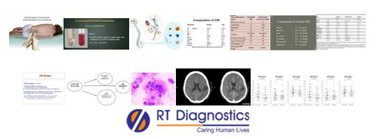 Sugar - CSF | RT Diagnostics
