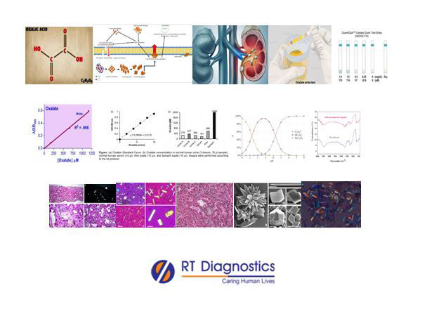 Urine (24 Hrs) - Oxalate 24 Hr | RT Diagnostics