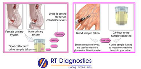 24 Hr Urine Creatinine Clearence | RT Diagnostics