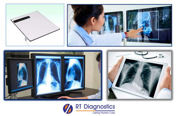Digital X Ray - Chest | RT Diagnostics